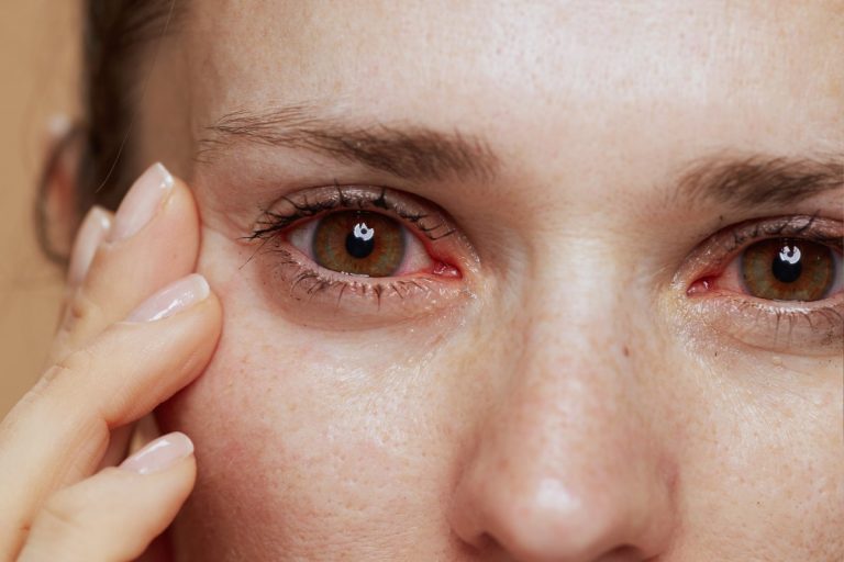 Allarme visivo: occhi rossi e pressione alta